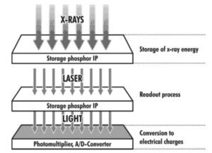Chapter V. Comparison of screen-film and digital receptors ...