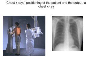 Chapter IV. Common x-ray procedures - Radiological Services
